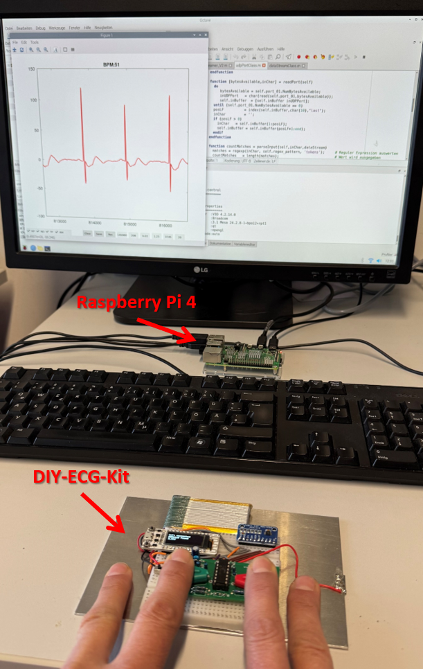 DIY-ECG Project